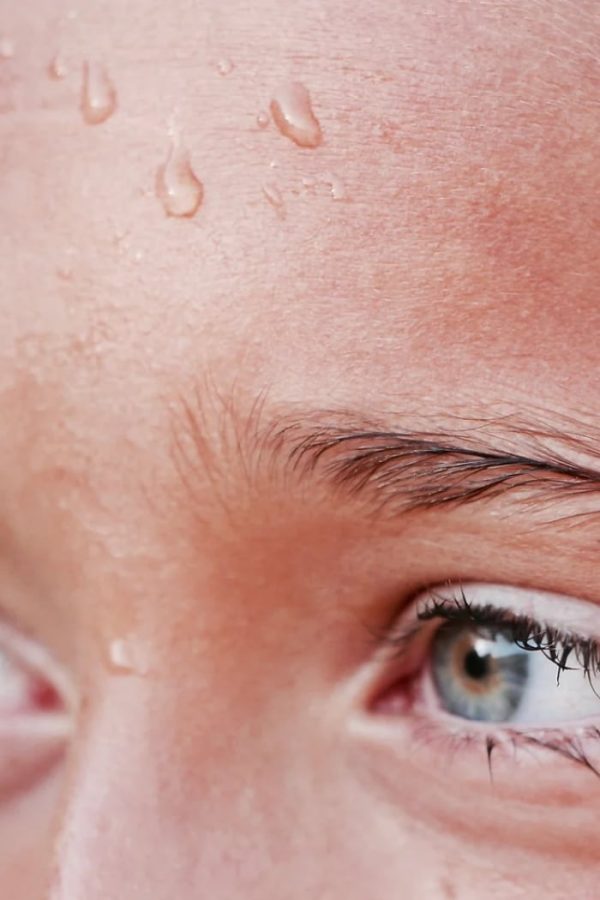 What Causes Excessive Sweating & Can It Be Treated? - Ambra Aesthetic ...